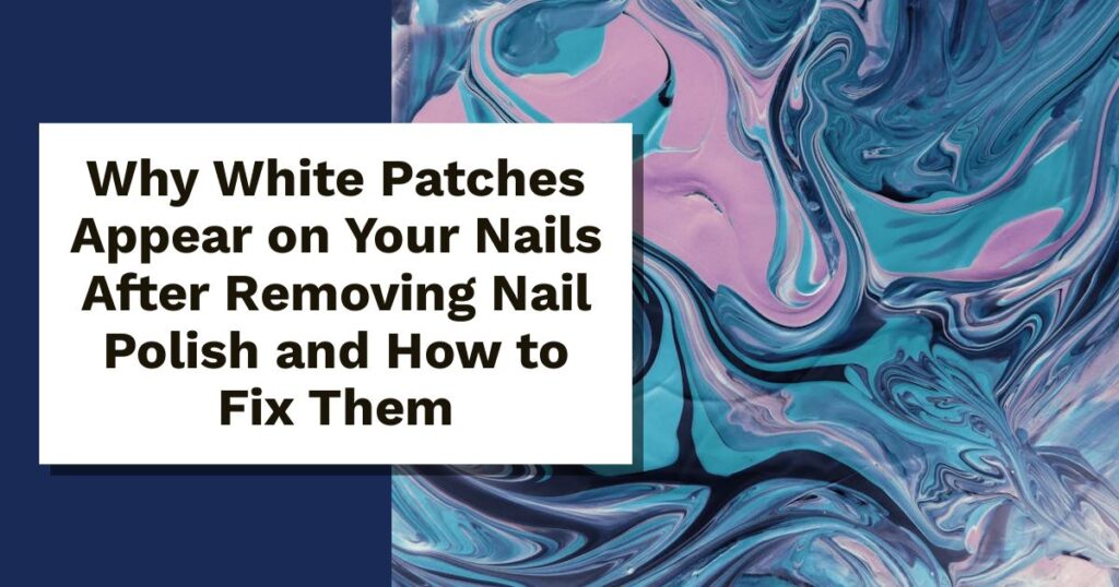 Why White Patches Appear on Your Nails After Removing Nail Polish and ...